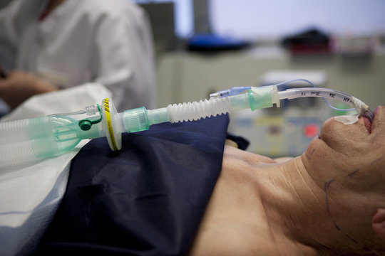 รูปภาพIntubation – เลือกดูภาพถ่ายสต็อก เวกเตอร์ และวิดีโอ2,979 | Adobe ...