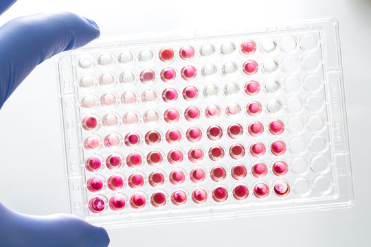 รูปภาพImmunoassay – เลือกดูภาพถ่ายสต็อก เวกเตอร์ และวิดีโอ847 | Adobe Stock