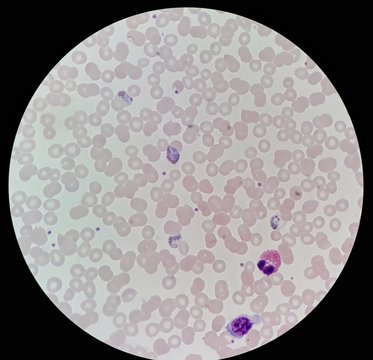 Plasmodium Vivax Labeled