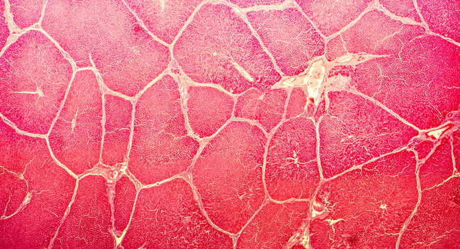 Liver Cell Under Microscope