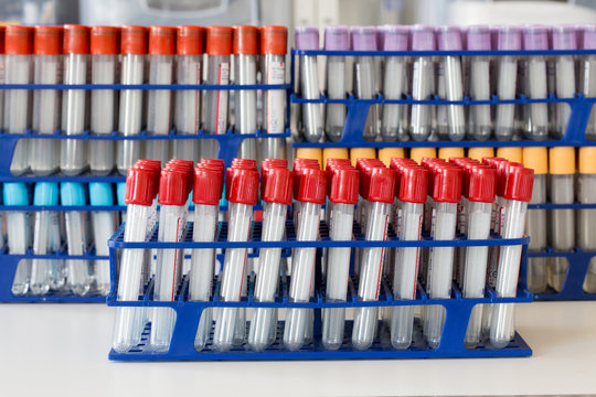 "Becton Dickinson" Images – Browse 63 Stock Photos, Vectors, and Video ...