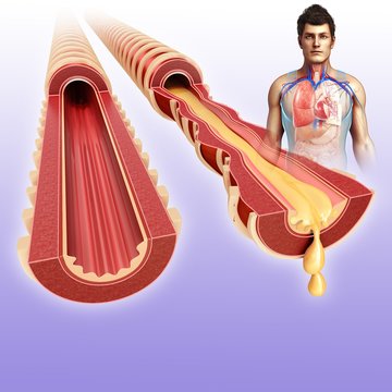Mucus Bilder – Durchsuchen 40,340 Archivfotos, Vektorgrafiken und ...