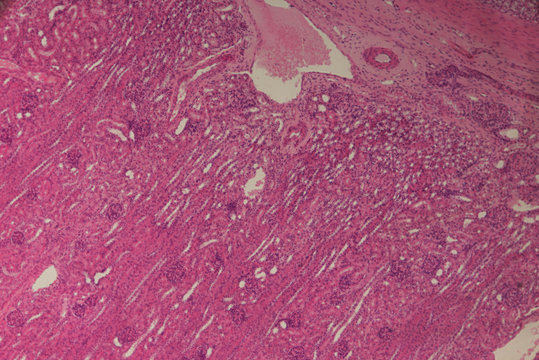 รูปภาพBlastoma – เลือกดูภาพถ่ายสต็อก เวกเตอร์ และวิดีโอ72 | Adobe Stock