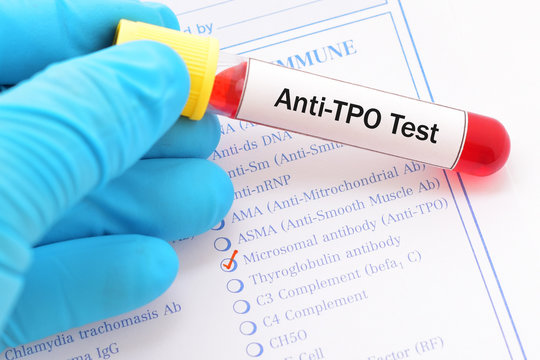 Microsomal Images – Browse 51 Stock Photos, Vectors, and Video | Adobe ...