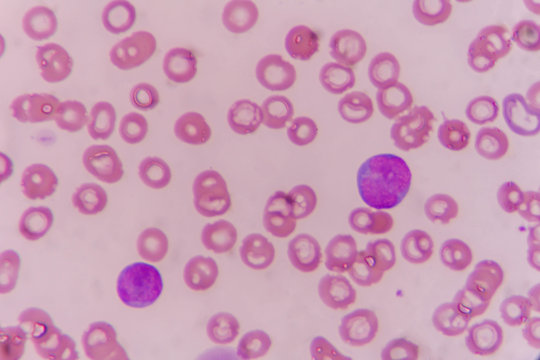 Myelocyte Images – Browse 166 Stock Photos, Vectors, and Video | Adobe ...