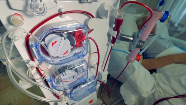 รูปภาพDialyzer – เลือกดูภาพถ่ายสต็อก เวกเตอร์ และวิดีโอ13,122 | Adobe Stock