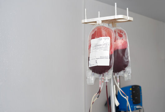 รูปภาพHemotransfusion – เลือกดูภาพถ่ายสต็อก เวกเตอร์ และวิดีโอ883 ...