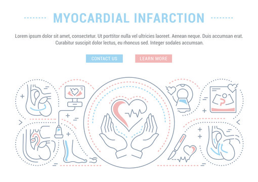 รูปภาพMyocardial – เลือกดูภาพถ่ายสต็อก เวกเตอร์ และวิดีโอ7,768 | Adobe ...