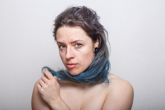 Portrait With Blemish Images – Browse 12,836 Stock Photos, Vectors, and ...