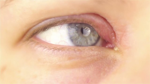 Meibom Bilder – Durchsuchen 32 Archivfotos, Vektorgrafiken und Videos ...