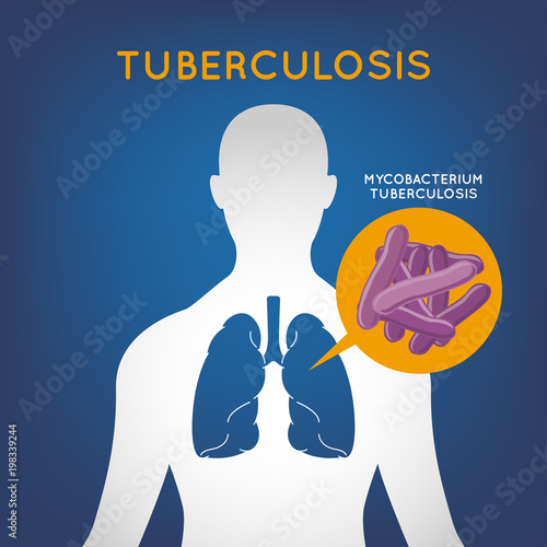 Tuberculosis Symbol