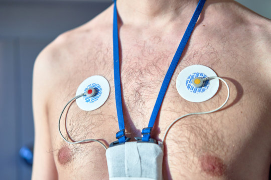 Imagens de Holter – Explore Fotografias do Stock, Vetores e Vídeos de ...