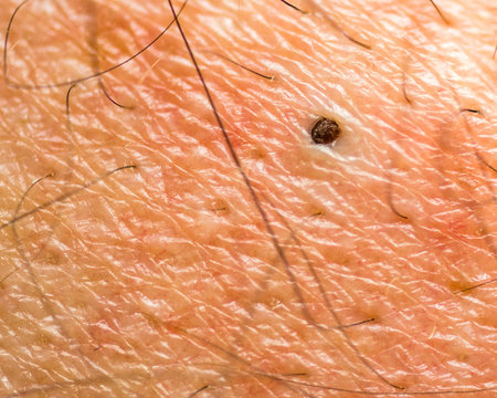 รูปภาพEffloreszenz – เลือกดูภาพถ่ายสต็อก เวกเตอร์ และวิดีโอ6 | Adobe Stock