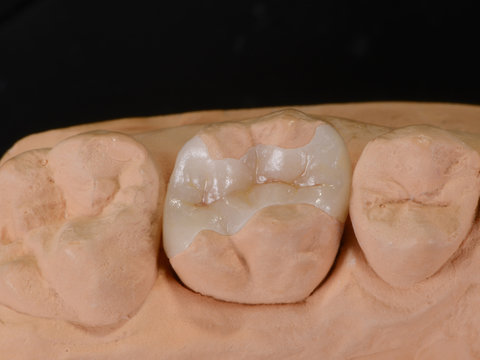 Backenzahn Images – Browse 52 Stock Photos, Vectors, and Video | Adobe ...