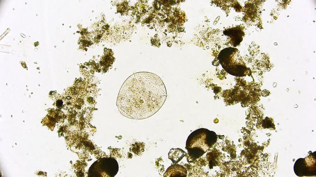 Ciliat Bilder – Durchsuchen 2,551 Archivfotos, Vektorgrafiken und ...