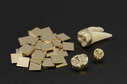 Zahngold Bilder – Durchsuchen 19,917 Archivfotos, Vektorgrafiken und ...