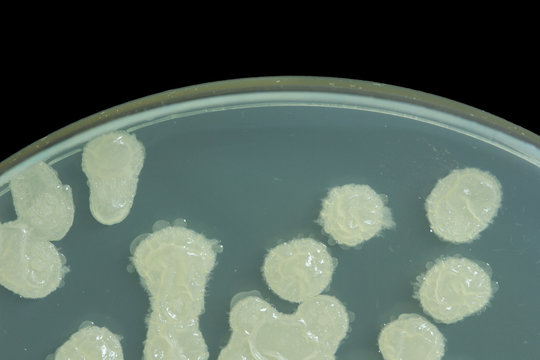 Bacillus Subtilis Agar