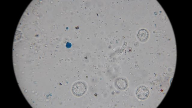 Hemolymph 이미지 – 찾아보기 233 스톡 사진, 벡터 및 비디오 | Adobe Stock