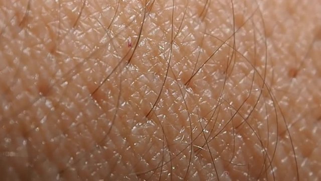 Derma Bilder – Durchsuchen 13,760 Archivfotos, Vektorgrafiken und ...