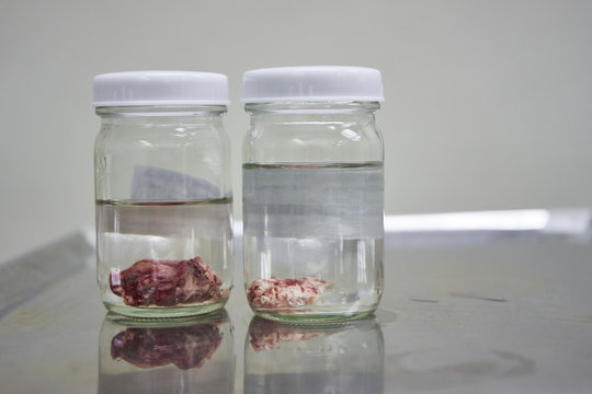 Formalin Bilder – Durchsuchen 2,053 Archivfotos, Vektorgrafiken und ...