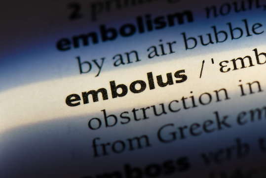 Embolus Images – Browse 355 Stock Photos, Vectors, and Video | Adobe Stock
