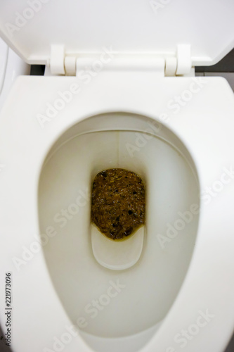 "Feces in public toilet, Users who forget to flush the toilet.Dirty ...