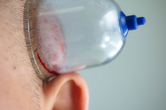 Cupping Images – Browse 6,201,304 Stock Photos, Vectors, and Video ...