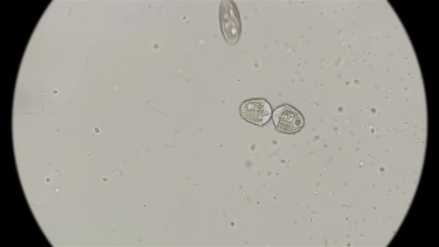 Coleps Bilder – Durchsuchen 28 Archivfotos, Vektorgrafiken und Videos ...