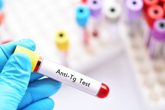 Microsomal Images – Browse 51 Stock Photos, Vectors, and Video | Adobe ...