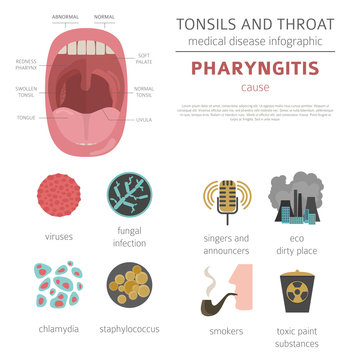 รูปภาพPharyngitis – เลือกดูภาพถ่ายสต็อก เวกเตอร์ และวิดีโอ37,632 ...