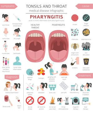 รูปภาพPharyngitis – เลือกดูภาพถ่ายสต็อก เวกเตอร์ และวิดีโอ37,632 ...