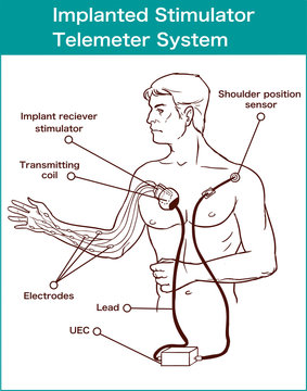 รูปภาพEncephalin – เลือกดูภาพถ่ายสต็อก เวกเตอร์ และวิดีโอ13 | Adobe Stock