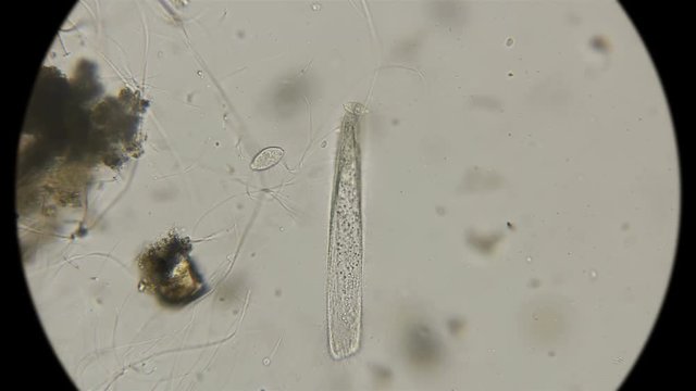 Spirostomum Under Microscope