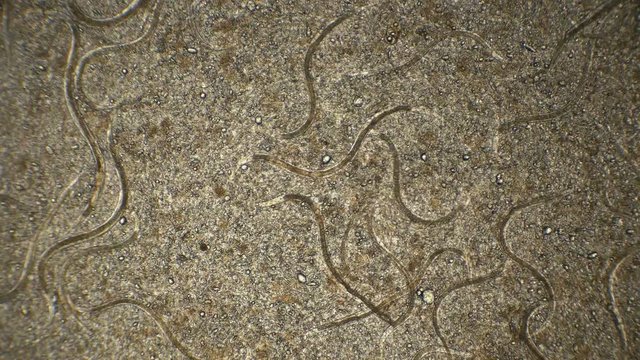 รูปภาพFilaria – เลือกดูภาพถ่ายสต็อก เวกเตอร์ และวิดีโอ584 | Adobe Stock