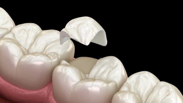 รูปภาพInlay – เลือกดูภาพถ่ายสต็อก เวกเตอร์ และวิดีโอ33,505 | Adobe Stock