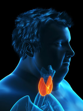 รูปภาพHyperthyroidism – เลือกดูภาพถ่ายสต็อก เวกเตอร์ และวิดีโอ6,248 ...