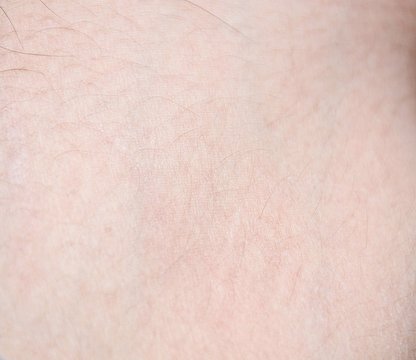 White Human Skin Texture