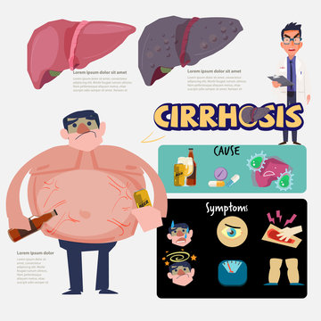 รูปภาพCirrhosis – เลือกดูภาพถ่ายสต็อก เวกเตอร์ และวิดีโอ12,845 | Adobe ...