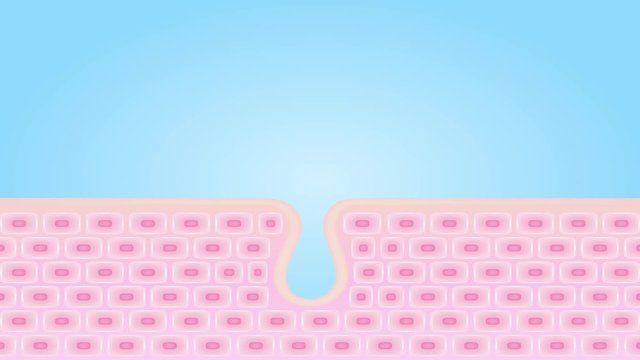 Microcomedones bilder – Bläddra bland 26 stockfoton, vektorer och ...