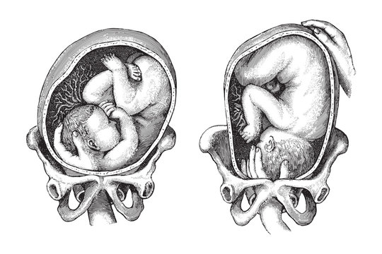 Plazenta Bilder – Durchsuchen 11,626 Archivfotos, Vektorgrafiken und ...