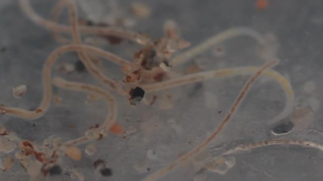 Threadworm Images – Browse 2,805 Stock Photos, Vectors, and Video ...