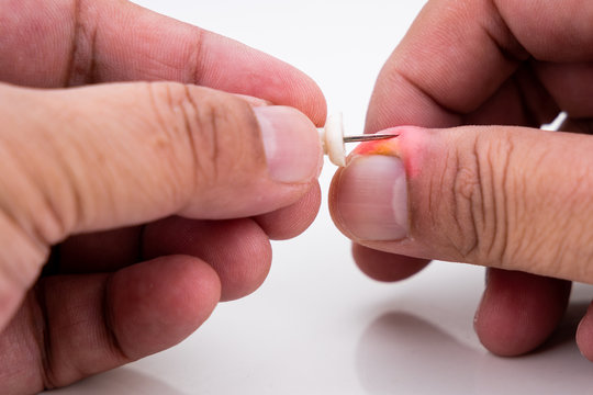 รูปภาพParonychia – เลือกดูภาพถ่ายสต็อก เวกเตอร์ และวิดีโอ362 | Adobe Stock