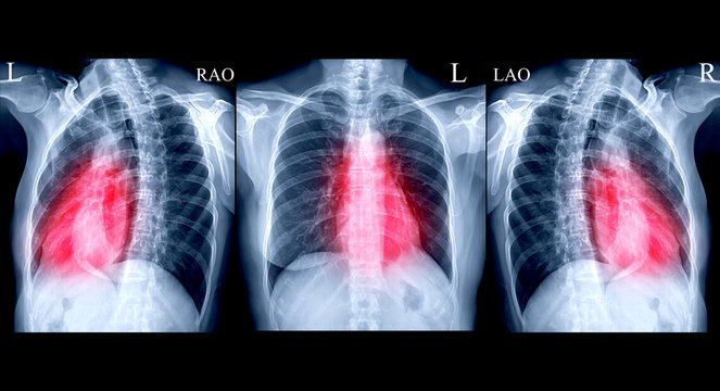 Rippenbruch-Bilder: Stock-Fotos & -Videos. | Adobe Stock