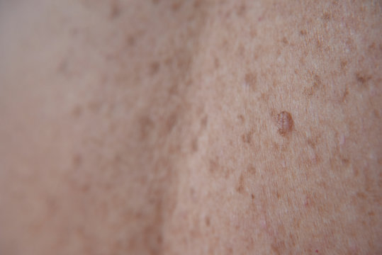 Spiloma bilder – Bläddra bland 9 stockfoton, vektorer och videor ...