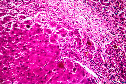 รูปภาพHepadnavirus – เลือกดูภาพถ่ายสต็อก เวกเตอร์ และวิดีโอ359 | Adobe ...