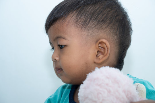 รูปภาพMumps – เลือกดูภาพถ่ายสต็อก เวกเตอร์ และวิดีโอ6,357 | Adobe Stock