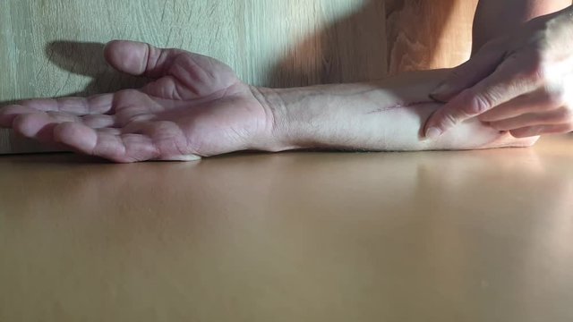 "Hand Scratch" Immagini - Sfoglia 32 foto, vettoriali e video Stock ...