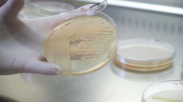 Bacteria Plate Images – Browse 15,044 Stock Photos, Vectors, and Video ...