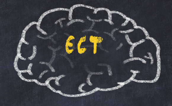 「Ect」の画像 - 6,677 件の Stock 写真、ベクターおよびビデオ | Adobe Stock