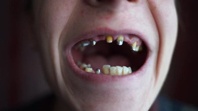Bad Teeth Images – Browse 62,389 Stock Photos, Vectors, and Video ...